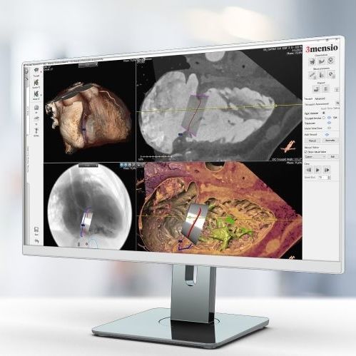 Image analysis software - Pie Medical Imaging - reporting / import ...