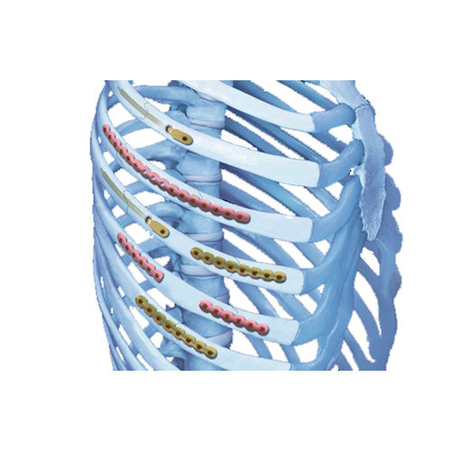 Rib compression plate - MatrixRIB™ - Depuy Synthes - thoracic / locking ...