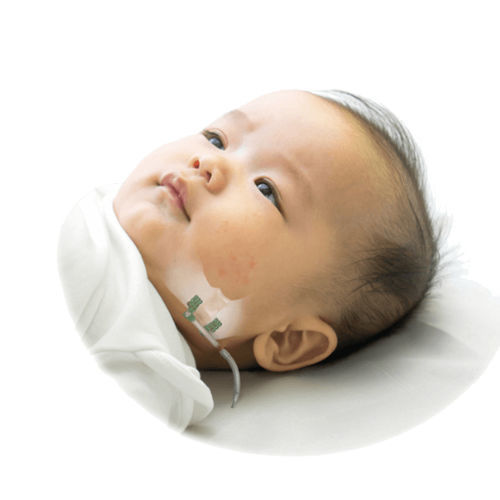 Mandibular distractor - Depuy Synthes - internal / pediatric