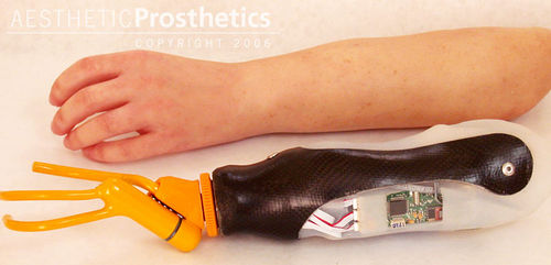 Myo-electric hand prosthesis - Aesthetic Prosthetics - hook clamp / adult