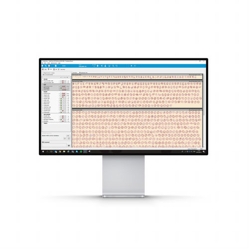 Image analysis web application - Cellavision AB - visualization ...
