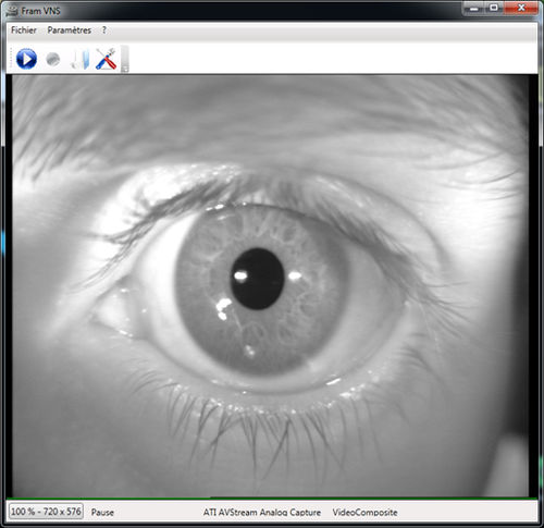 Video recording software - FRAMVIDEO - Framiral - medical / video recording