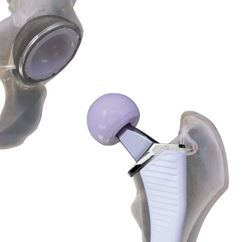 Primary hip prosthesis - Cordera™ - ConforMIS - cementless