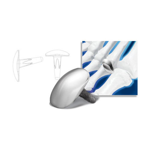 Metatarsophalangeal joint implant - LMH™ - Wright Medical Technology