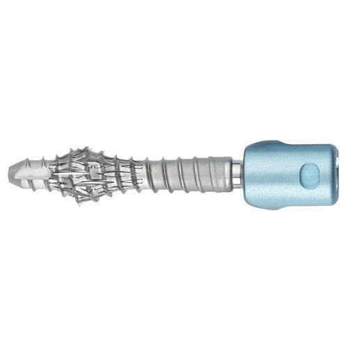 Thoracic-lumbar vertebra pedicle screw - OSSEOSCREW® - Alphatec Spine ...