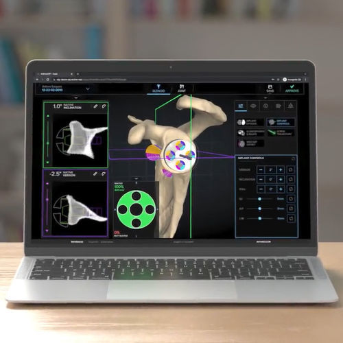 Preoperative planning software - VIP - Arthrex - calibration ...