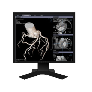 CT software - Xelis™ Cardiac - INFINITT North America - angiography ...