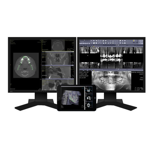 Medical imaging PACS - INFINITT Dental - INFINITT North America - web-based