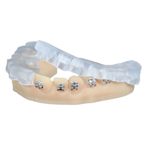 Resin dental material - KeyOrtho IBT™ - Stratasys - for therapeutic ...
