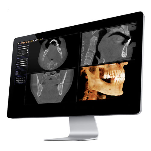 3D viewing software - Invivo - Anatomage - measurement / sharing / medical