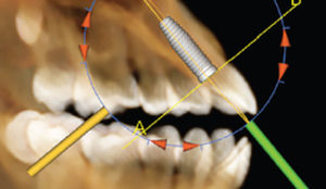 3D viewing software module - Anatomage - planning / for dental implant ...