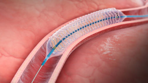 Coronary stent - DESolve™ - Elixir Medical - PLLA / bioresorbable