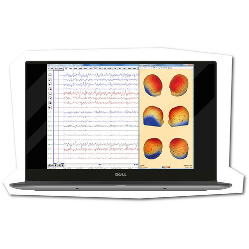 Analysis software - BESA - Brainbox - data analysis / medical / EEG