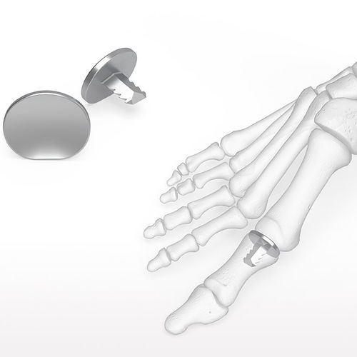 Interphalangeal foot joint implant - Hemi™ - Acumed - first toe joint