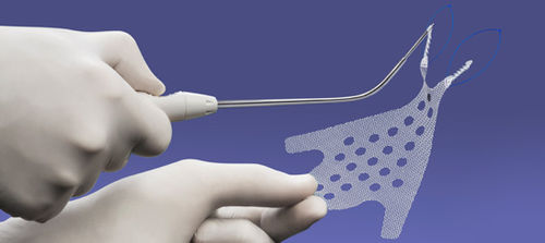 Pelvic Floor Reconstruction Reconstruction Mesh Calistar Promedon Women