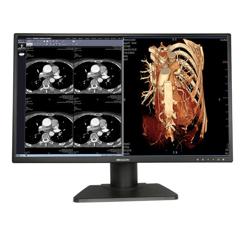 High-definition display - C616W - Shenzhen Beacon Display Technology ...