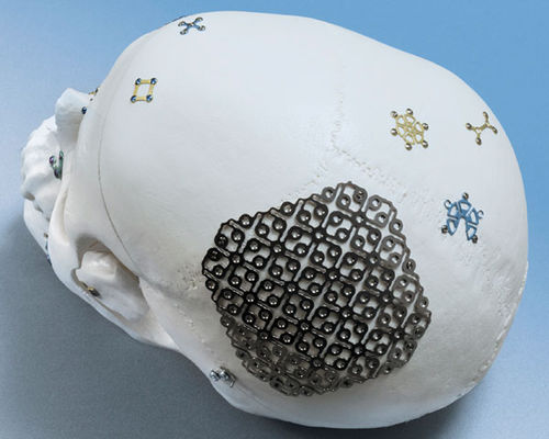 Non-absorbable cranial fixation system - OPTIMUS - OSTEONIC