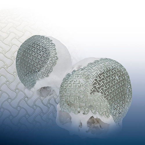 Custom-made cranial implant - REAL FIT - OSTEONIC