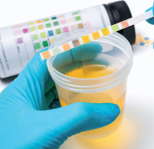 Urinalysis test strip - URS series - Paramedical srl - for urine ...