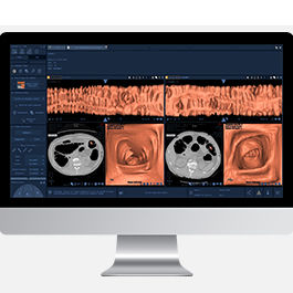 Oncology software module - Myrian® XP-Colon - Intrasense - endoscopy ...