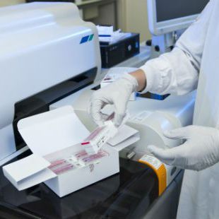 Lung cancer test kit - Lumipulse® - Fujirebio - serum / plasma / CLEIA