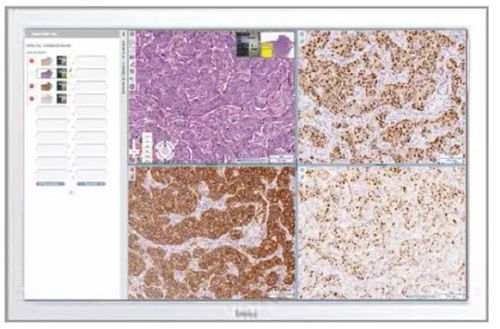 Management software - Aperio eSlide Manager - Leica Biosystems - viewer ...