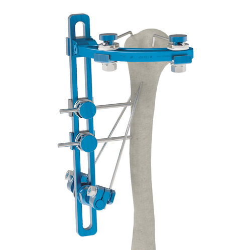 Modular external fixation system - FEP - MIKAI - humerus / tubular / adult