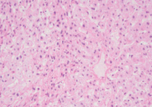 Staining solution reagent - 04-140808 - BIO-OPTICA Milano - for ...