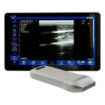 Hand-held ultrasound system - All medical device manufacturers
