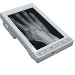 Hand-held vein finder, Hand-held vein viewer - All medical device ...