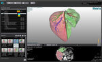 MRI software - All medical device manufacturers