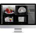 MRI software - All medical device manufacturers