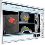 MRI software - All medical device manufacturers