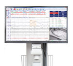 Polysomnography software - All medical device manufacturers