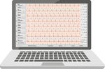 Electrocardiography software, ECG software - All medical device ...