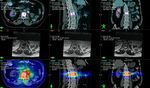 MRI software - All medical device manufacturers