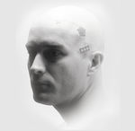 Cranial fixation system - All medical device manufacturers