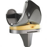 Cemented knee prosthesis - All medical device manufacturers