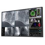 Radiology,Medical imaging displays - All medical device manufacturers ...