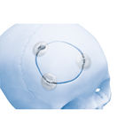 Cranial fixation system - All medical device manufacturers
