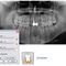 Medical software - Gendex™ VixWin™ Platinum - DEXIS - dental ...