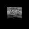 Clinical software - Rivent™ - ContextVision - for ultrasound imaging ...