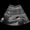 Clinical software - Rivent™ - ContextVision - for ultrasound imaging ...
