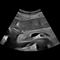 Cardiovascular software - Rivent™ - ContextVision - for ultrasound ...