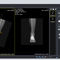 Radiography software - VXvue with PureImpact™ - Vieworks - for ...