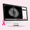Mammography software - VXvue Mammo - Vieworks - management / viewer ...
