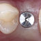 Dental implant surgery instrument kit - Hahn™ - Glidewell Europe