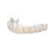 Resin dental prosthesis - Smile Transitions™ - Glidewell Europe ...