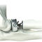 Radial head prosthesis - ALIGN ® - Skeletal Dynamics