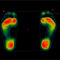 Portable baropodometry plateform - 3D ULTRASENSOR - Diasu Health ...